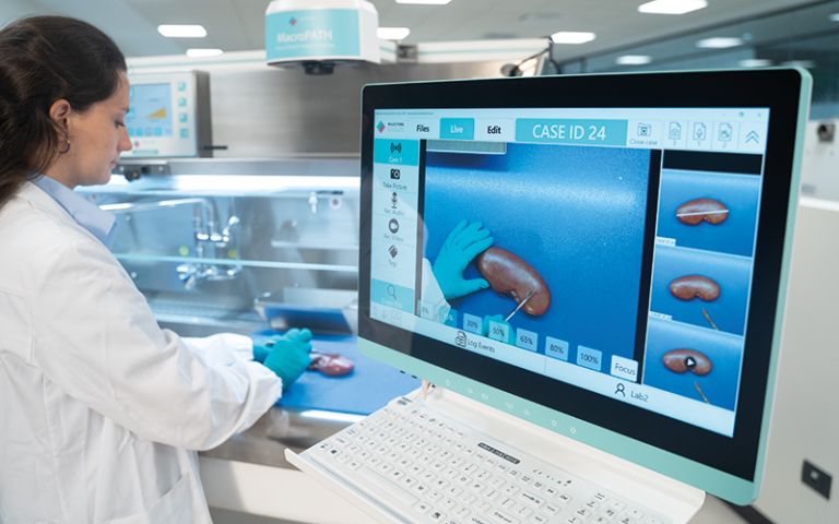 MacroPATH | Milestone Medical