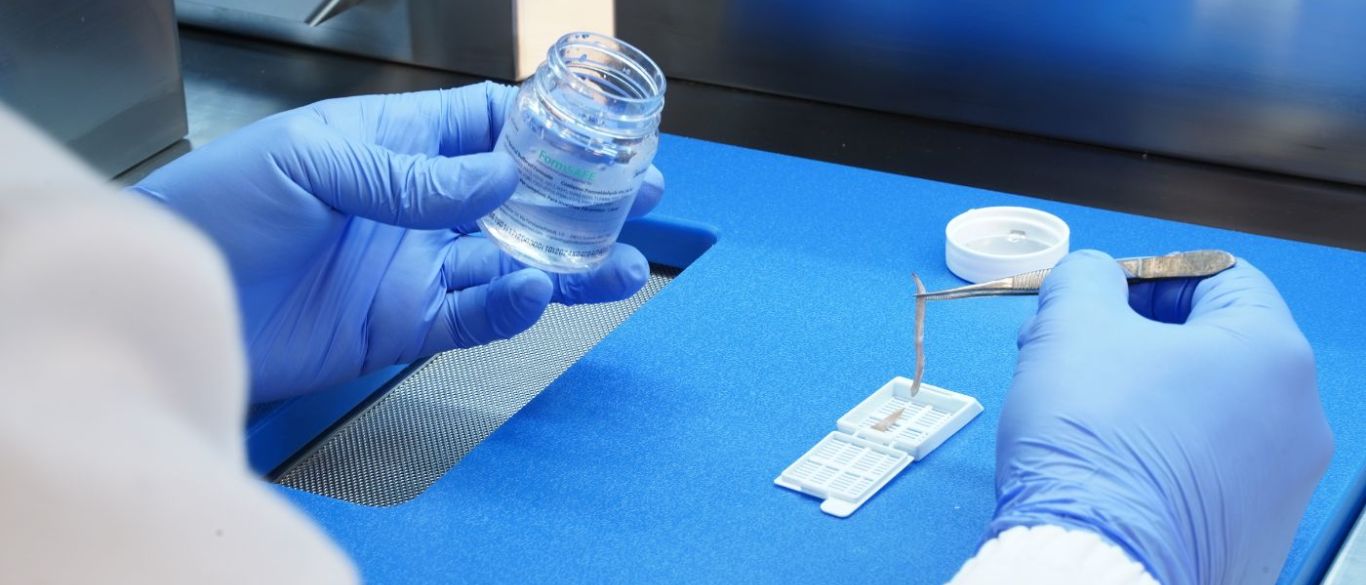 Step-by-Step Guide to Streamlined Biopsy Handling and Processing ...