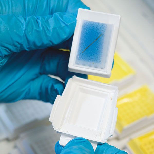 SYNERGY | Milestone Medical