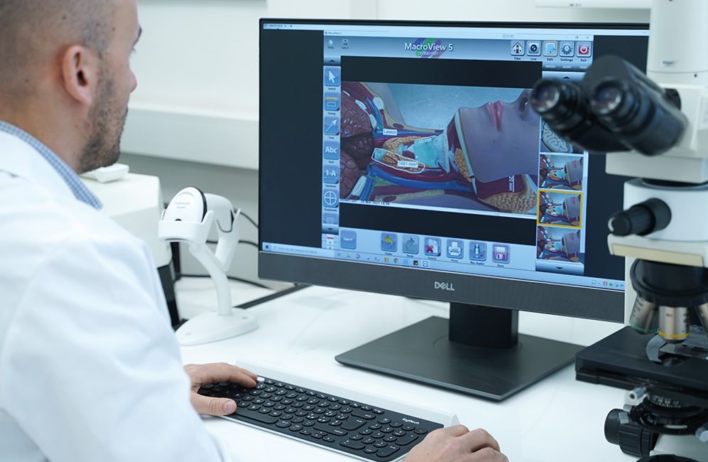 MacroVIEW | Milestone Medical