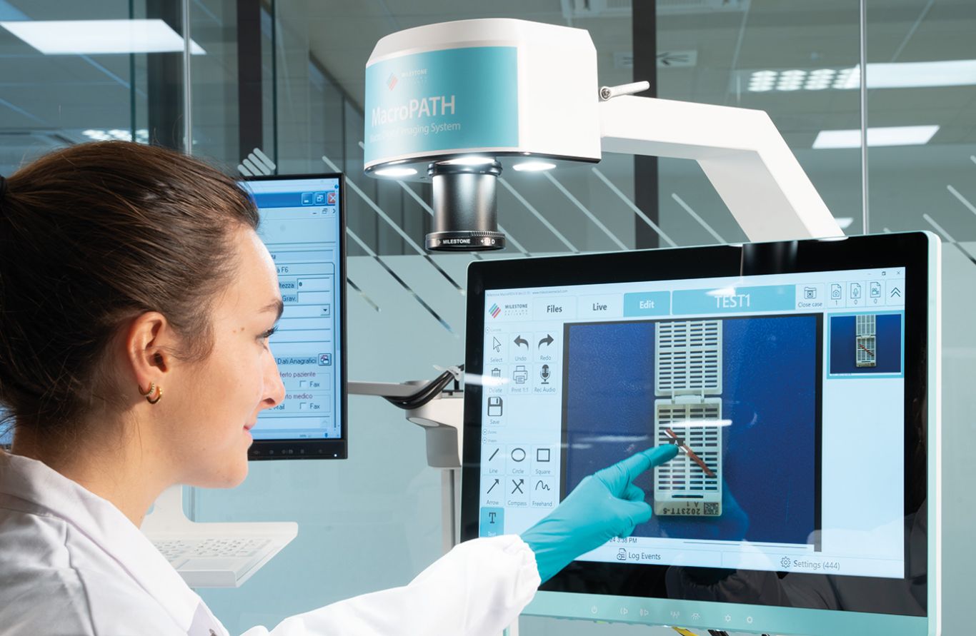 WorkSTATION | Milestone Medical