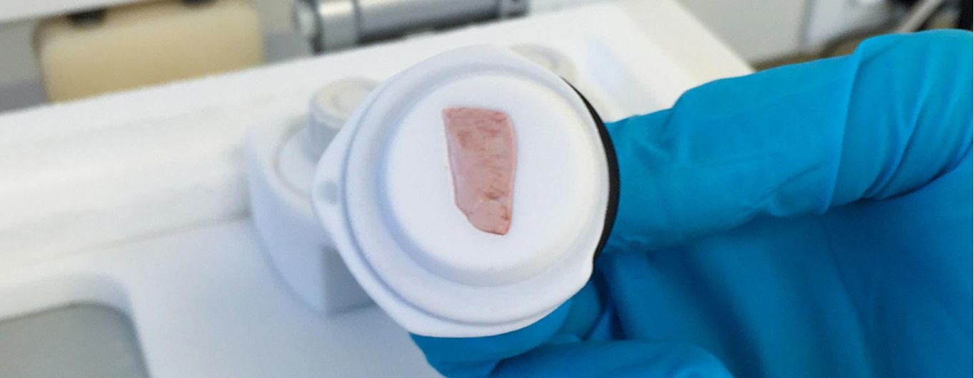 How to Enhance the Quality of your Frozen Sections | Milestone Medical