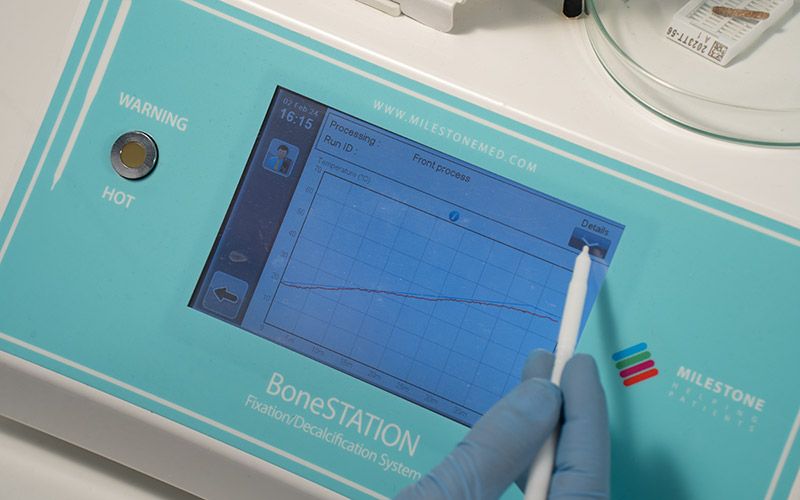 BoneSTATION | Milestone Medical