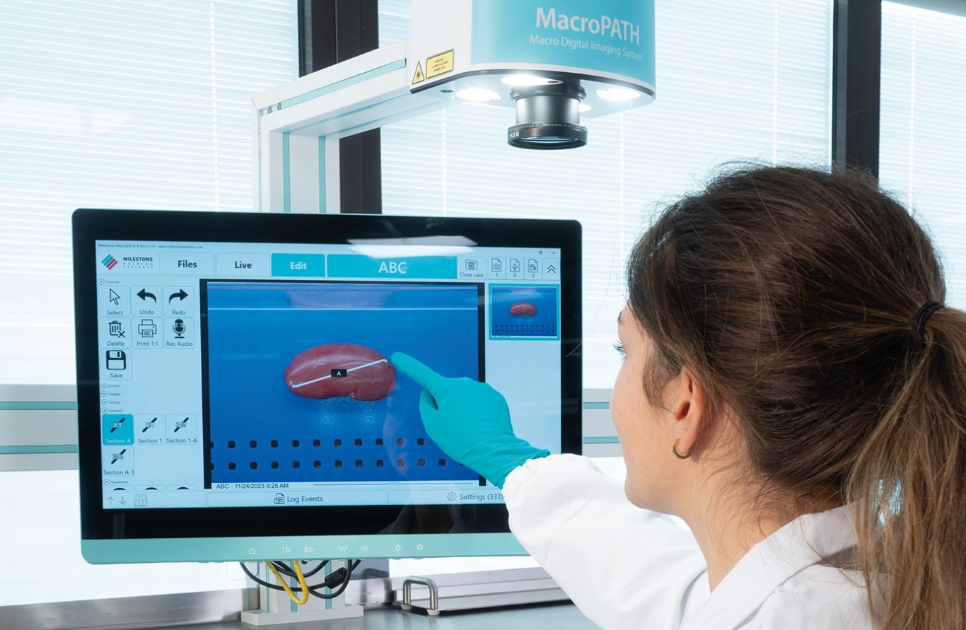 eGROSS | Milestone Medical