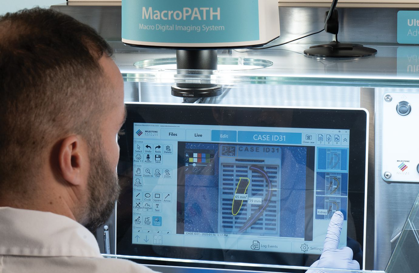 UltraCENTER | Milestone Medical