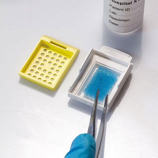 SYNERGY | Milestone Medical