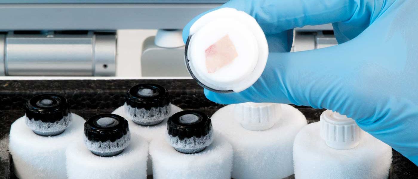 5 most common problems about Frozen Sections and how to solve them ...